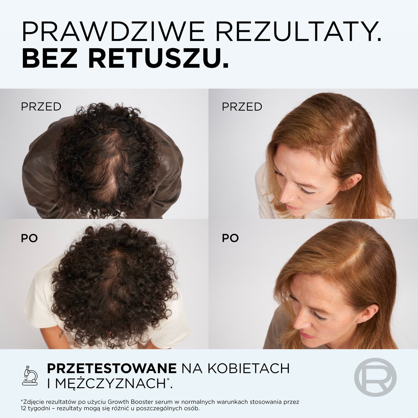 Elseve Growth Booster Serum do skóry głowy przeciw wypadaniu włosów | L ...